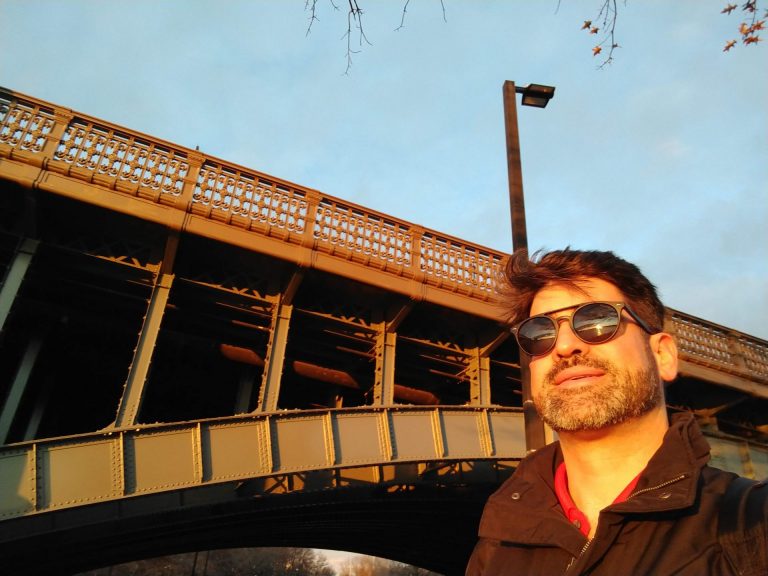 Rhinoplasty in Brazil | Dr. Gabriel Bijos